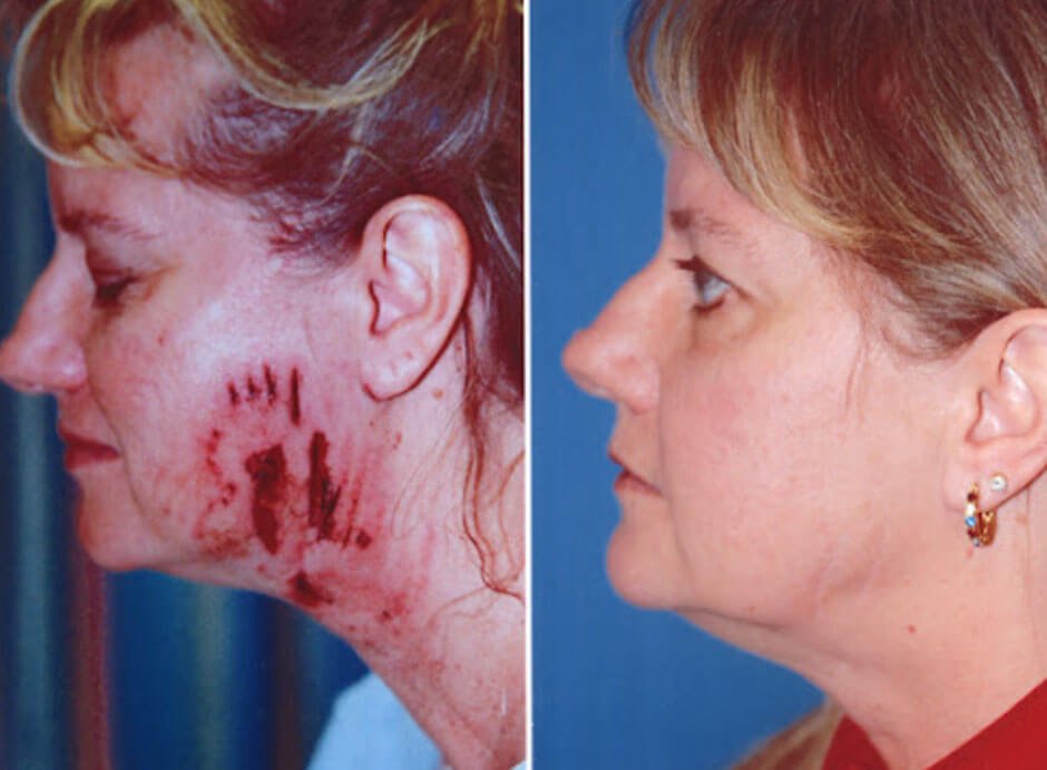 3 Ways Plastic Surgery Can Help After An Injury To The Face | 100% Norway